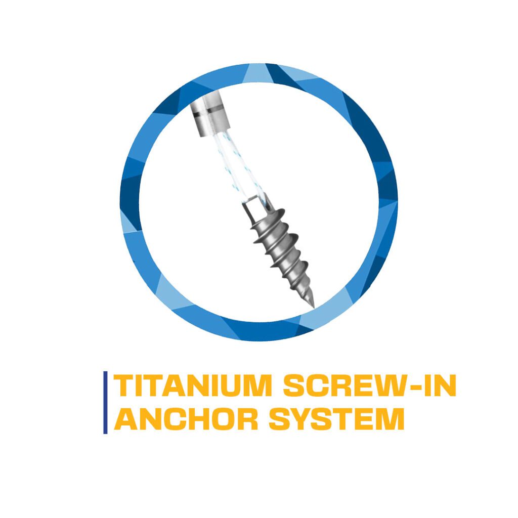 Titanium Screw In Anchor System Archives - Orthopedic SS